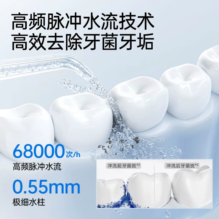 Ultrasonic Tooth Scaler: The Ultimate Home Teeth Cleaning Tool—Portable ...