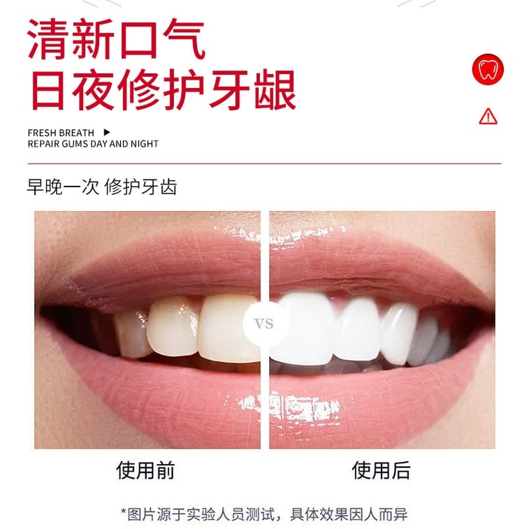 SUNFLOWER Dental Separators For Sensitive Teeth 100g Per Tube | Yami