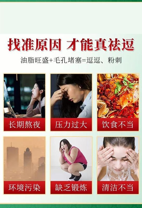 香港大药房 祛痘膏30g/盒 去粉刺膏修护痘印痘坑青春痘祛痘霜粉刺 | 亚米